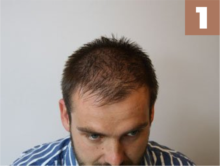 HAIR THICKENING FIBERS STEP-BY-STEP GUIDE – Mane Europe